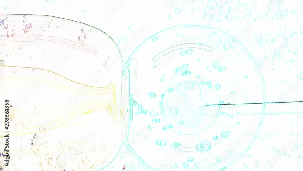 Microscopic view of drug delivery into cell, needle puncture of cell ...