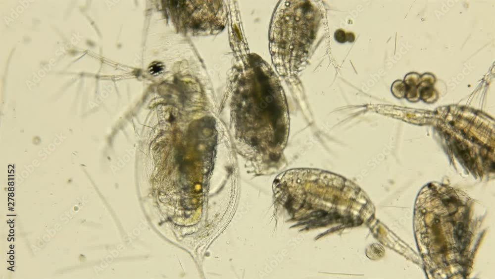 Zooplankton under the microscope. A colony of different plankton ...