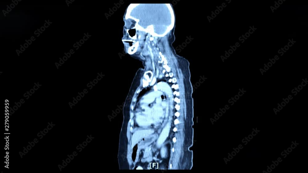 motion x-ray image of body inside by mri scanner or ct scan. Stock ...