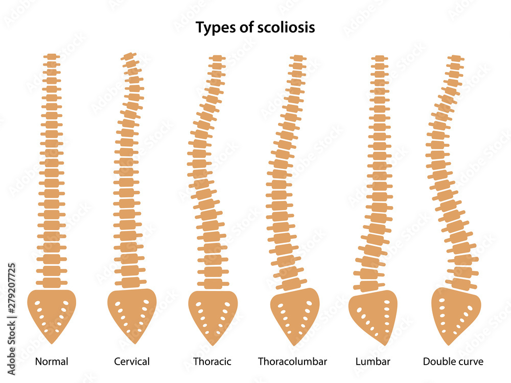 Curved Spine Clipart