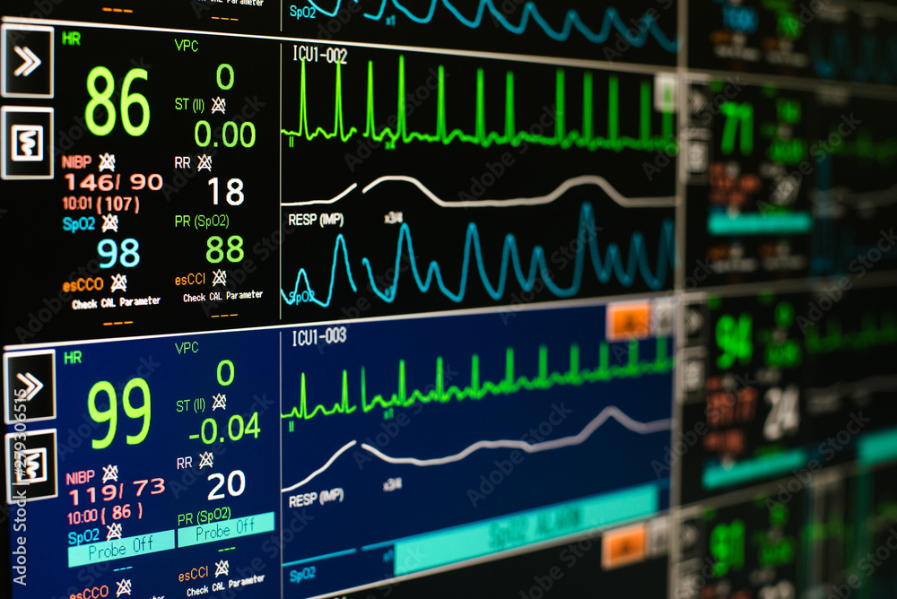 Modern Vital Signs Monitor Display At ICU In Hospital Stock Photo 