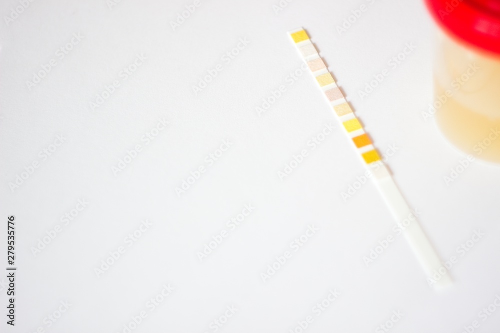 Urine test strip, container, gloves and test chart on white background ...