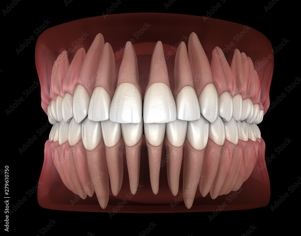 Morphology of mandibular and maxillary human gum and teeth. Medically ...