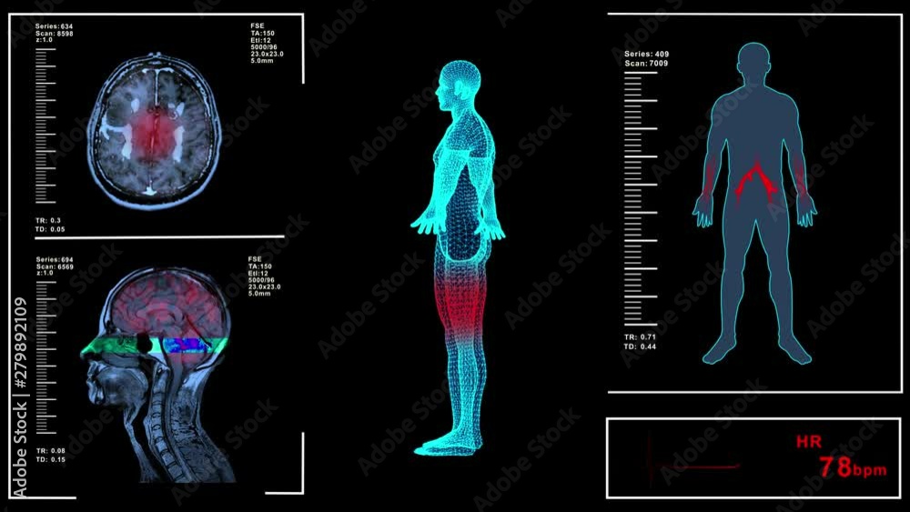 Futuristic HUD Medicine Screen Data. Scanning of a human brain activity ... Futuristic HUD Medicine Screen Data. Scanning of a human brain activity ...