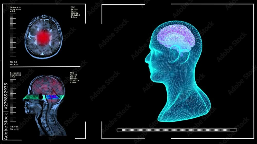 Futuristic HUD Medicine Screen Data. Scanning of human brain activity ... Futuristic HUD Medicine Screen Data. Scanning of human brain activity ...