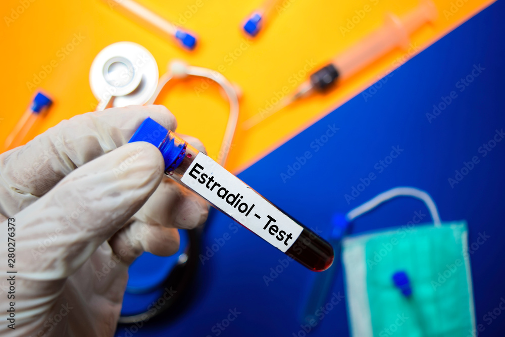 Estradiol - Test with blood sample. Top view isolated on color ...