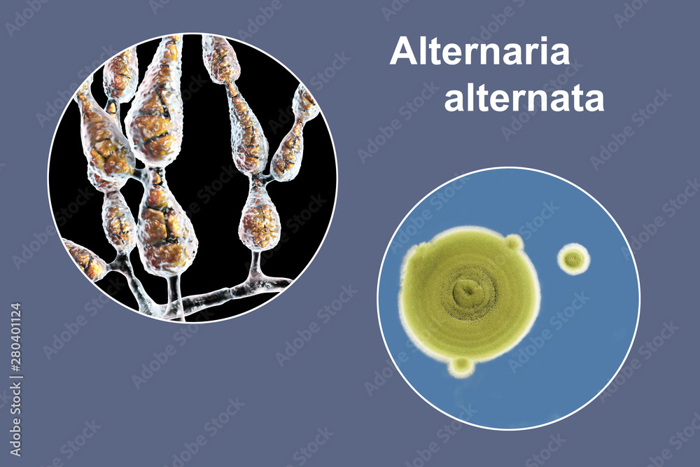 Mold Alternaria alternata, allergic fungus, 3D illustration and photo ...