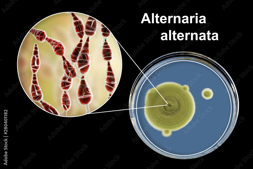 Mold Alternaria alternata, allergic fungus, 3D illustration and photo ...