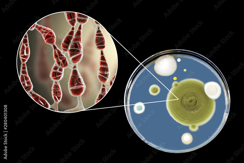 Mold Alternaria alternata, allergic fungus, 3D illustration and photo ...