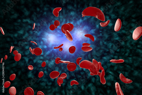 Sickle Cell Anemia 3D Illustration Stock Illustration | Adobe Stock