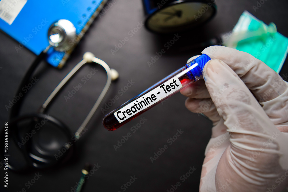 Creatinine - Test with blood sample. Top view isolated on black ...