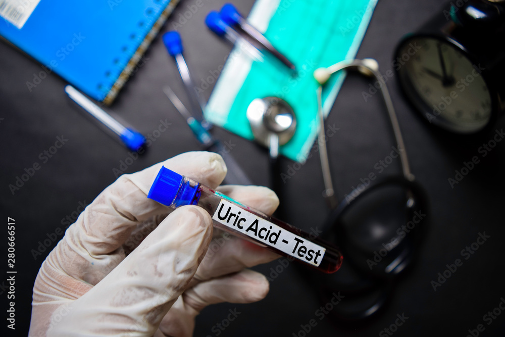 Uric Acid - Test with blood sample. Top view isolated on black ...