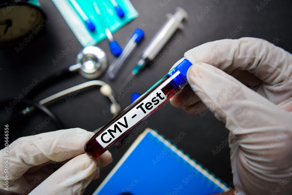 CMV - Test with blood sample. Top view isolated on black background ...