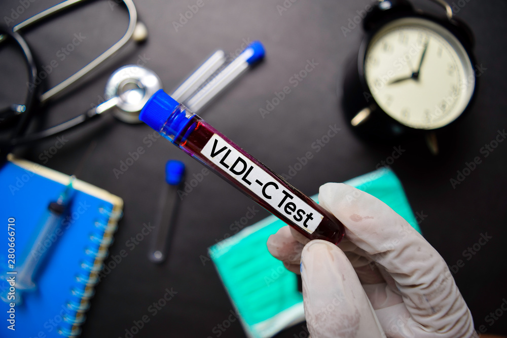 VLDL-C - Test with blood sample. Top view isolated on black background ...