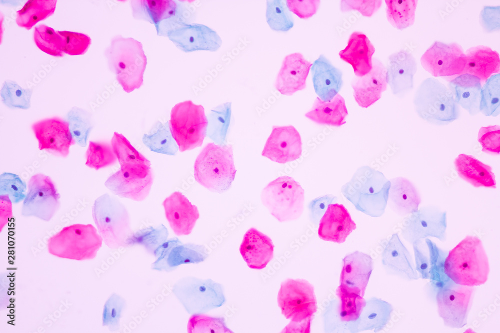 In Shape Of Normal Cervix Cell Under Microscope