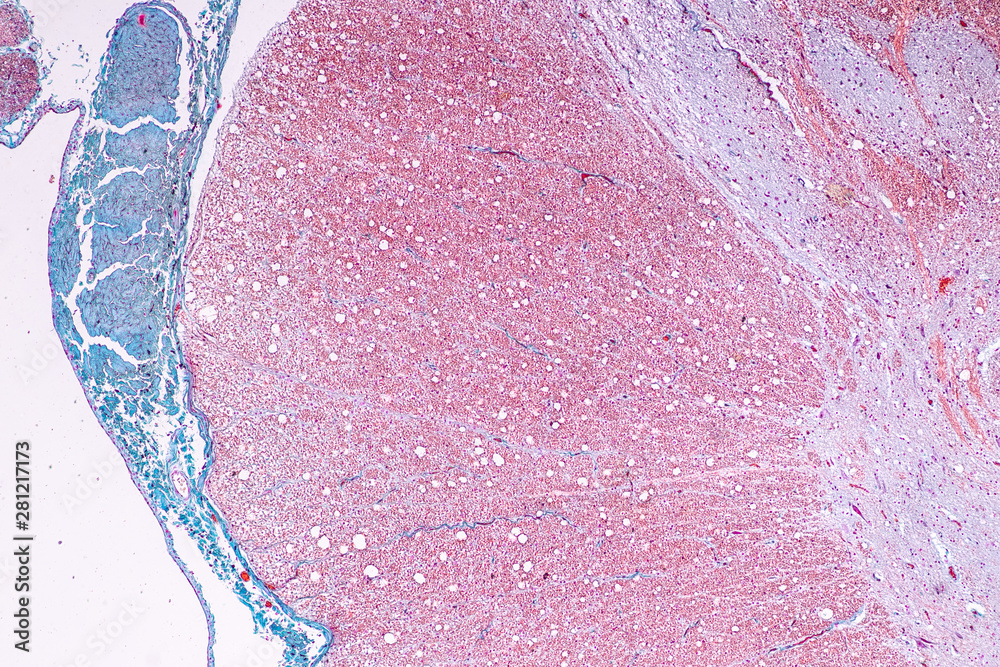 Education anatomy and Histological sample Spinal cord Tissue under the ...