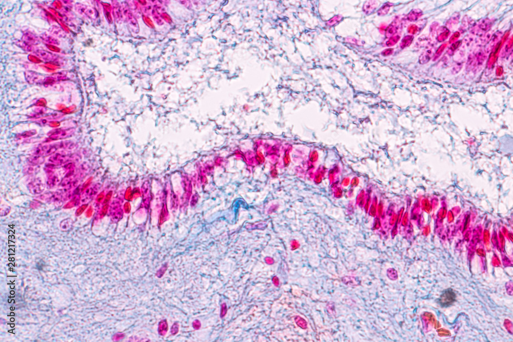 Education anatomy and Histological sample Spinal cord Tissue under the ...
