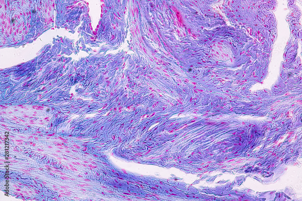 Education anatomy and Histological sample Spinal cord Tissue under the ...