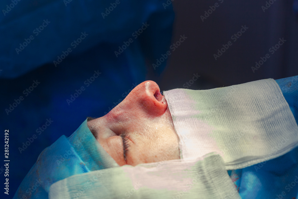 Foto de Surgeon and his assistant performing cosmetic surgery on nose ...