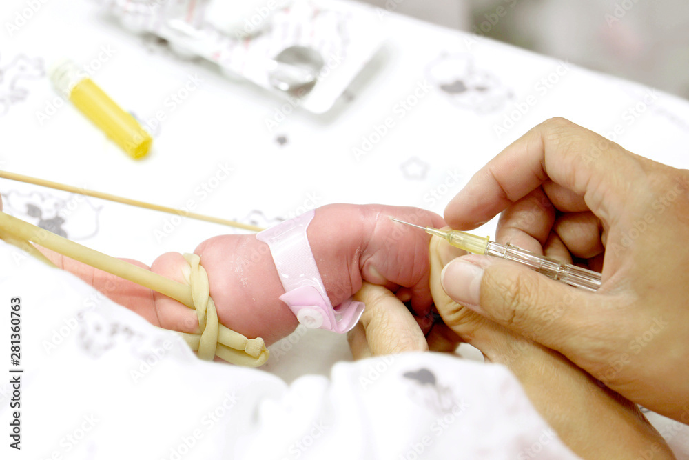 Image of nurse hands uses gradually stabbing IV Catheter (small medical ...