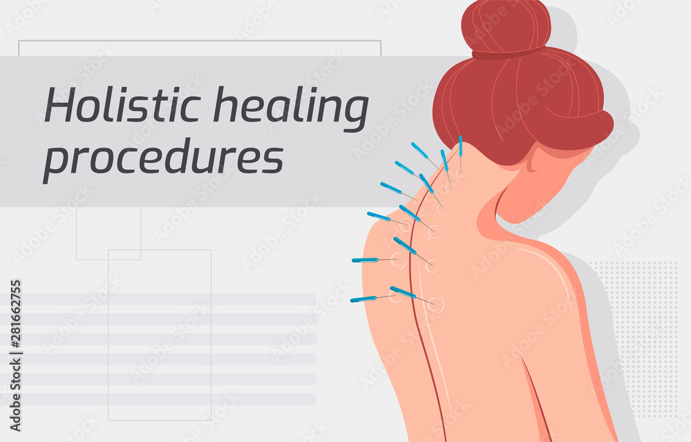 Vector flat vector illustration of medical procedure Stock Vector ...