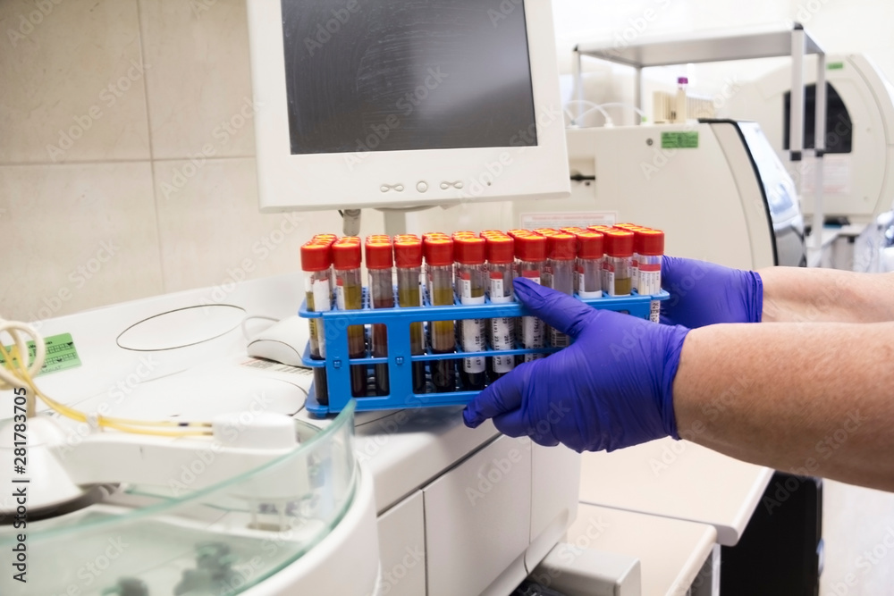 Biochemical laboratory. the technician hand puts a blood test tubes in ...