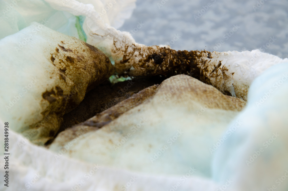 dirty diaper with poop on a white background in hands and close Stock ...