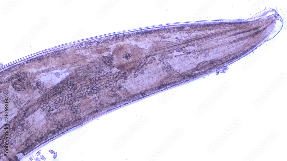 Microscopic image (whole mount prep) of a pregnant pinworm, scientific ...