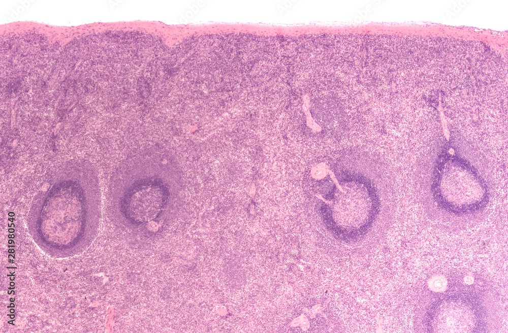 Histology of the human spleen, with red pulp and white pulp. Stock ...