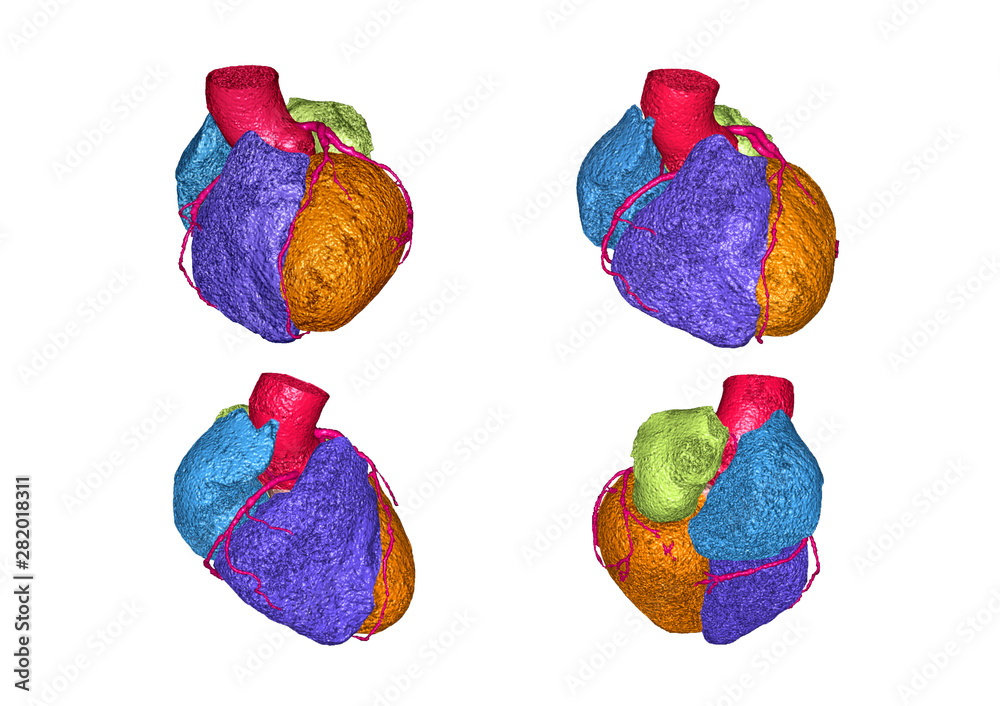 CTA Coronary artery 3D rendering image isolated on white background for ...