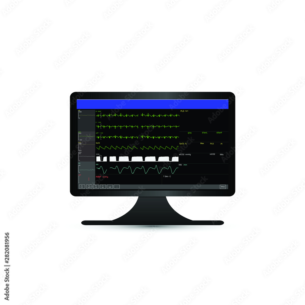 Computer monitoring and screen display of patient vital signs of ...