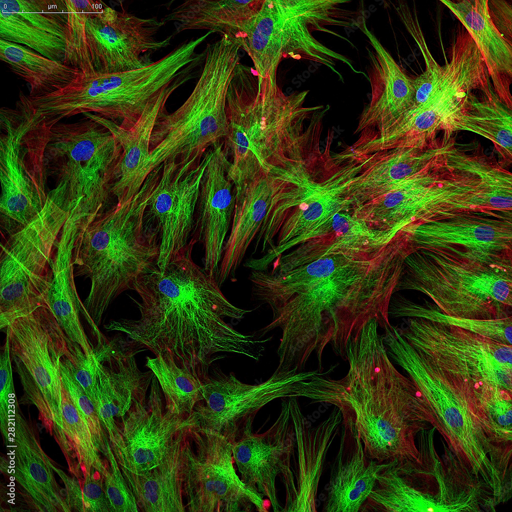 Fibroblast cells. Confocal light micrograph of mammalian fibroblast ...