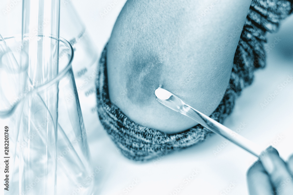 Skin allergy diseases problem, Close up of doctor doing treatment on ...