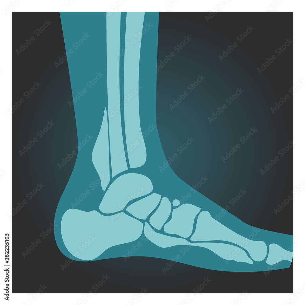 X-ray shot of foot side view, human body, bones, radiography, vector ...