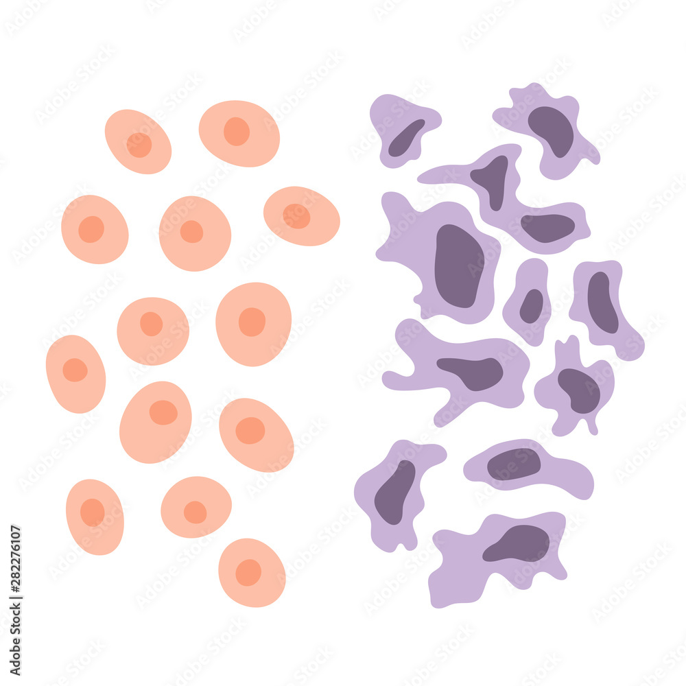 cell structure: normal and cancer Stock Vector | Adobe Stock