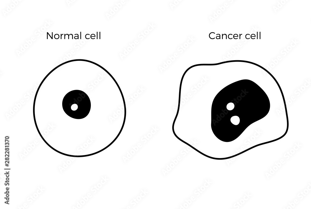 cell structure: normal and cancer Stock Vector | Adobe Stock
