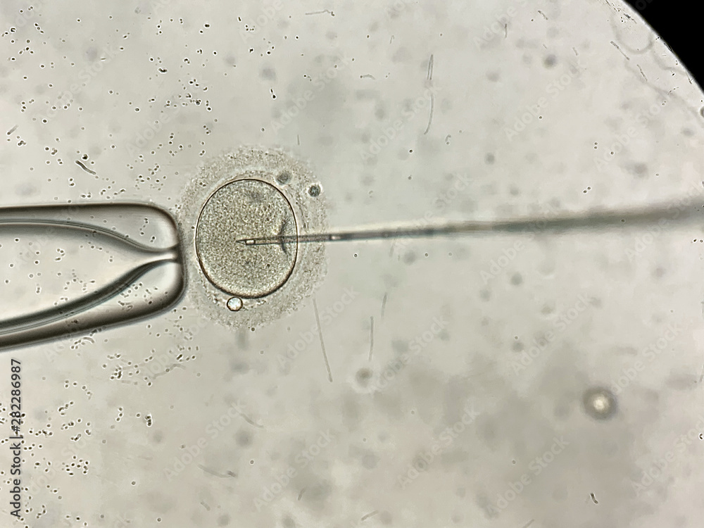 Poster View through microscope at in vitro fertilization process – Wall ...