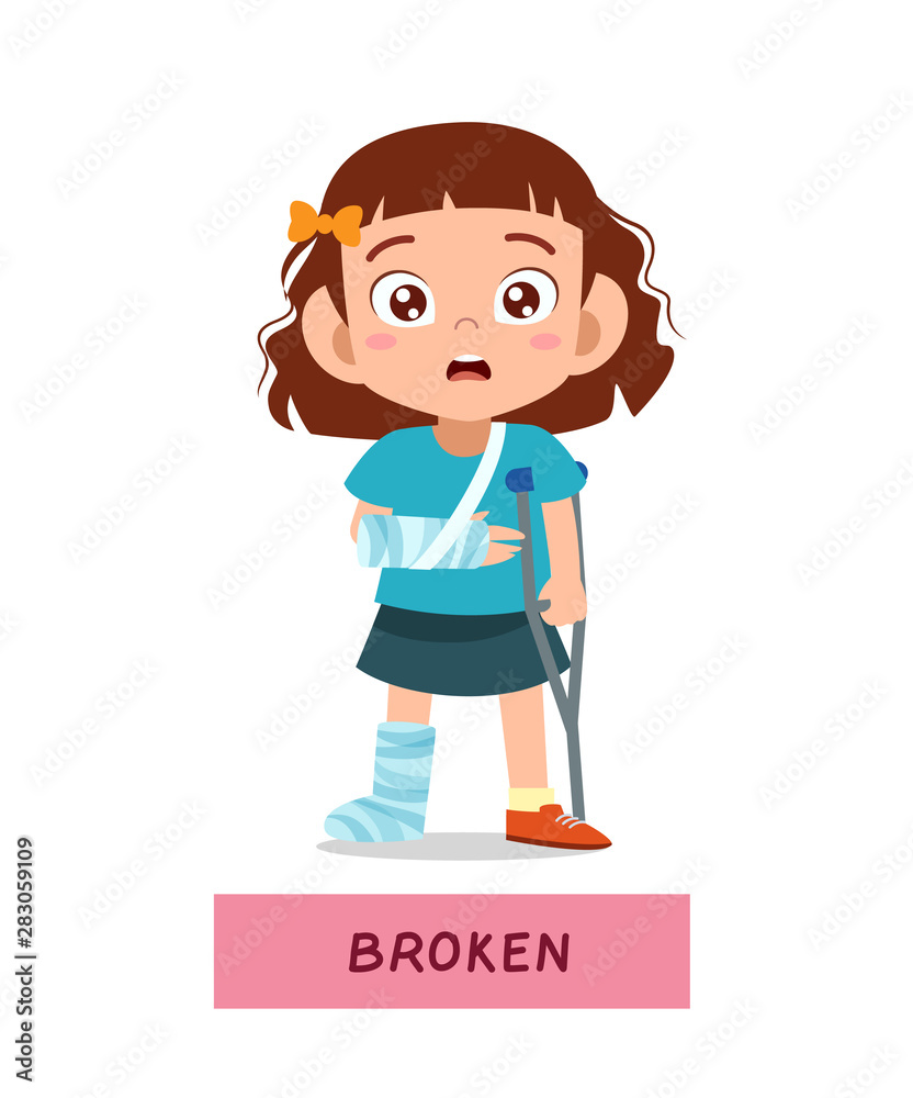 kid girl with fracture leg vector Stock Vector | Adobe Stock