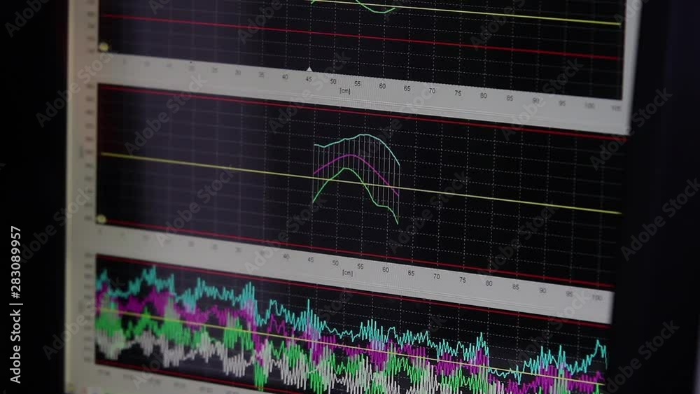 Diagram of indications on the display of the machine at production ...