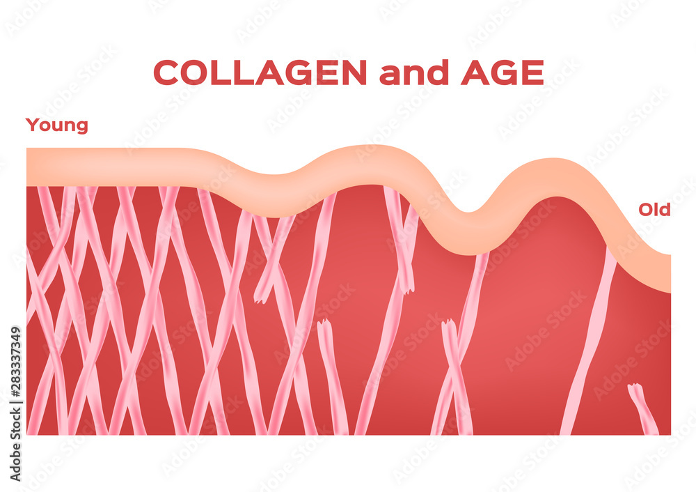 collagen in younger skin and aging graphic vector / age Stock Vector ...