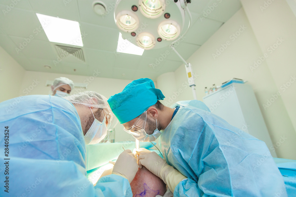 Baldness treatment. Hair transplant. Surgeons in the operating room ...