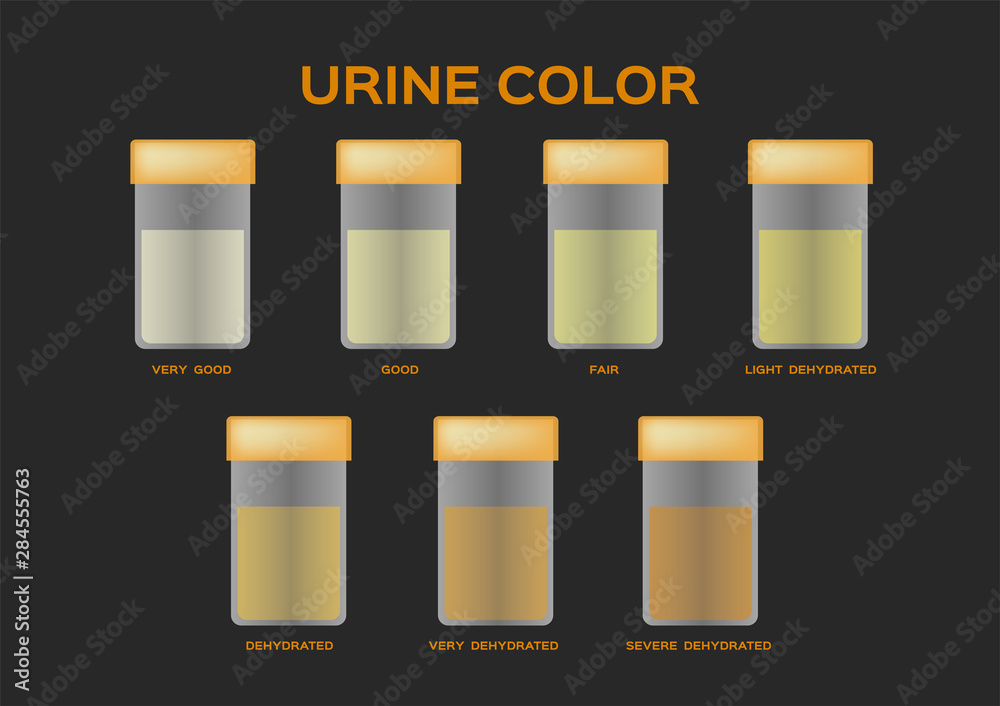 urine color vector / transparent yellow orange Stock Vector | Adobe Stock