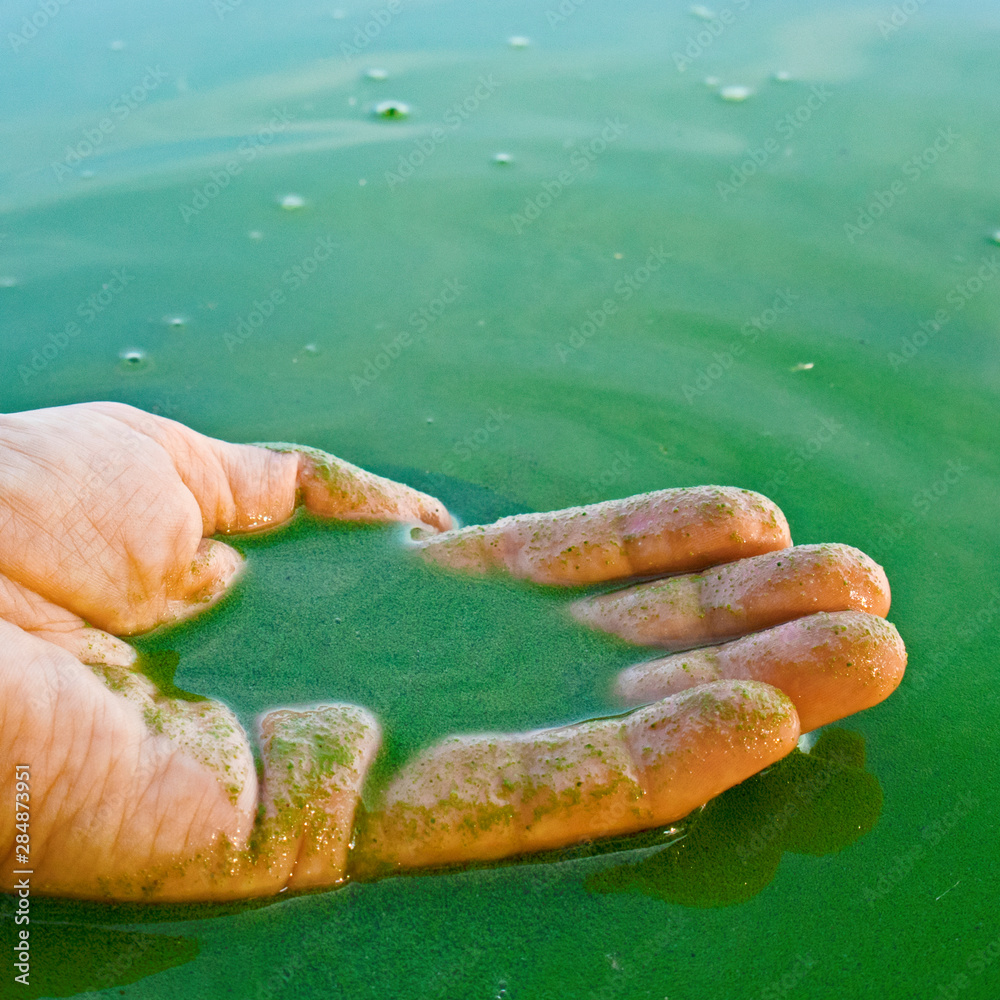 Foto de Human hand polluted with blue-green algae. Water pollution by ...