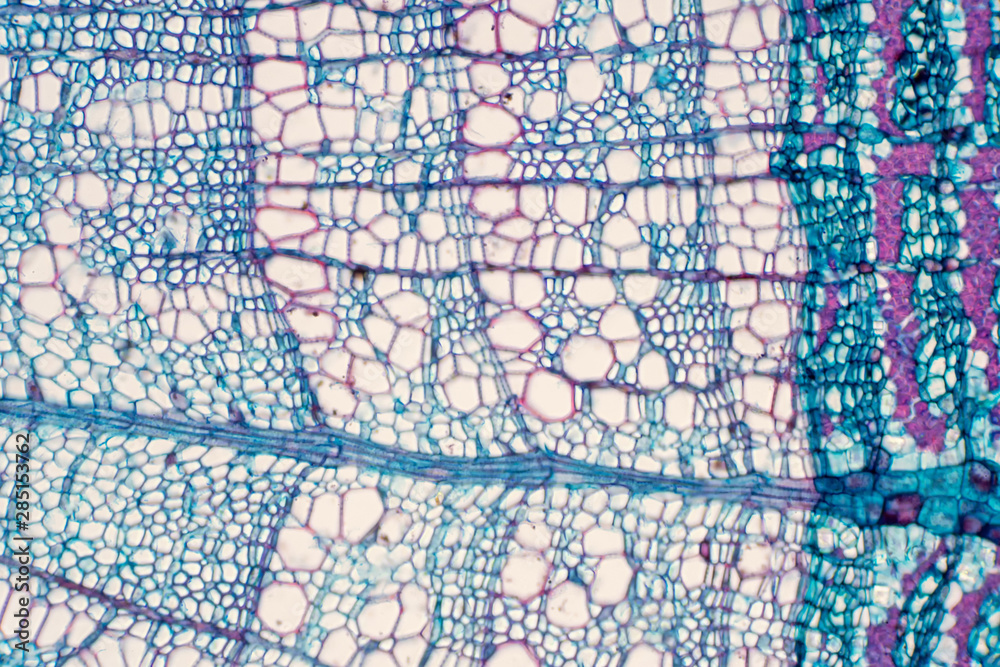 Cross section - Xylem is a type of tissue in vascular plants that ...