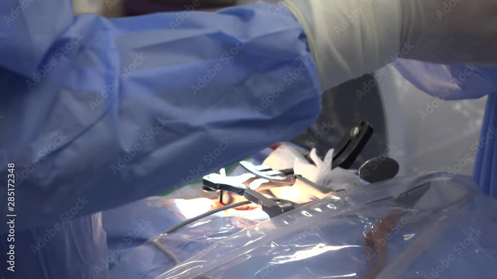 Minimally invasive surgeries encompass surgical techniques that limit ...