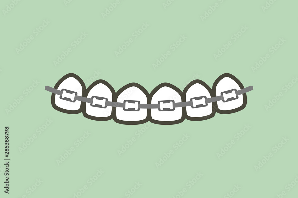 orthodontics teeth or dental braces - tooth cartoon vector flat style ...