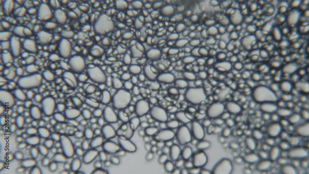 Highly magnified starch granules from a potato. Close up. Potato starch ...