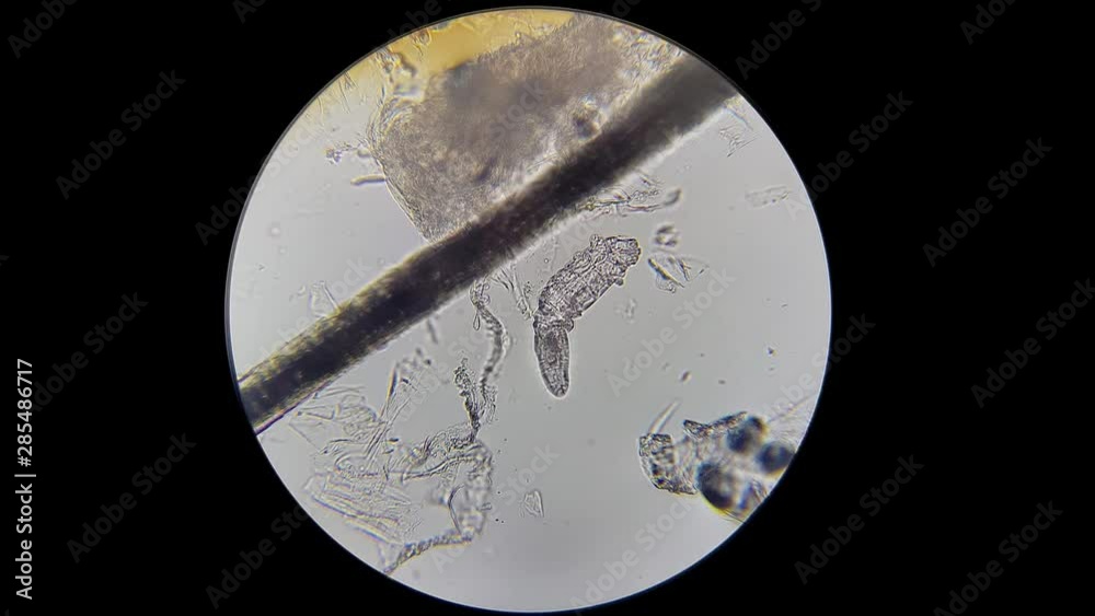 Demodex on dog's skin video taken with microscope under big ...