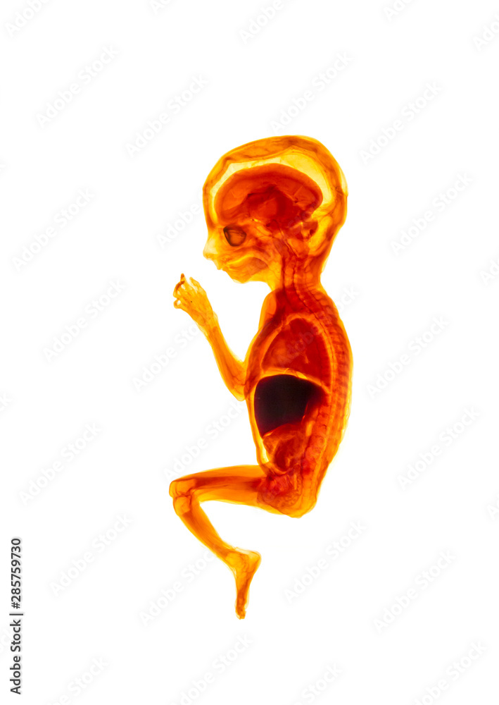 Human embryo reproduction, embryonic development Stock Photo | Adobe Stock