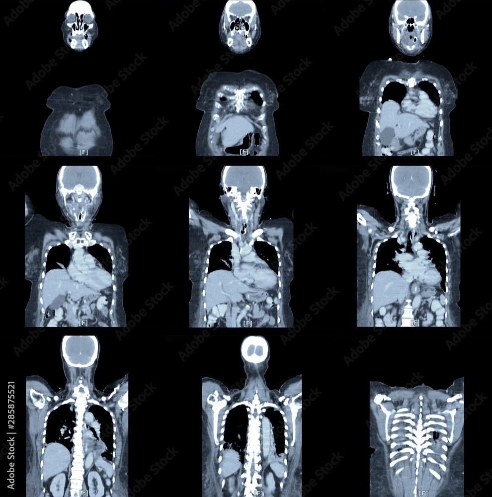 x-ray image mri scan Stock Photo | Adobe Stock